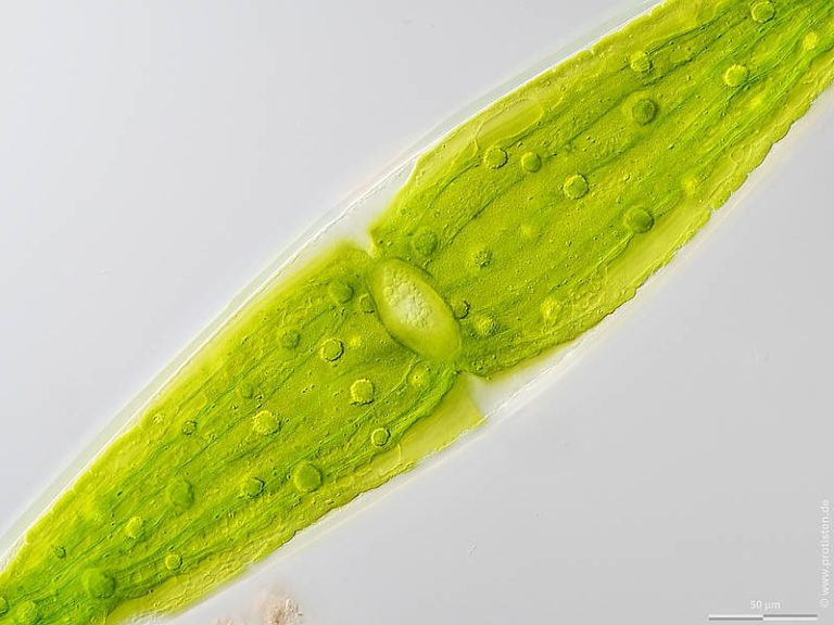Closterium lunula - Protisten.de