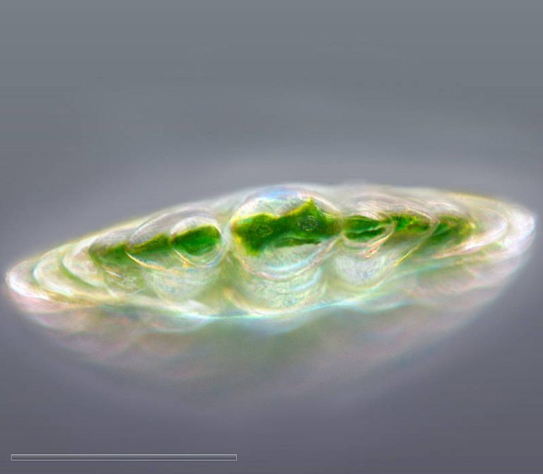 Micrasterias rotata - Protisten.de